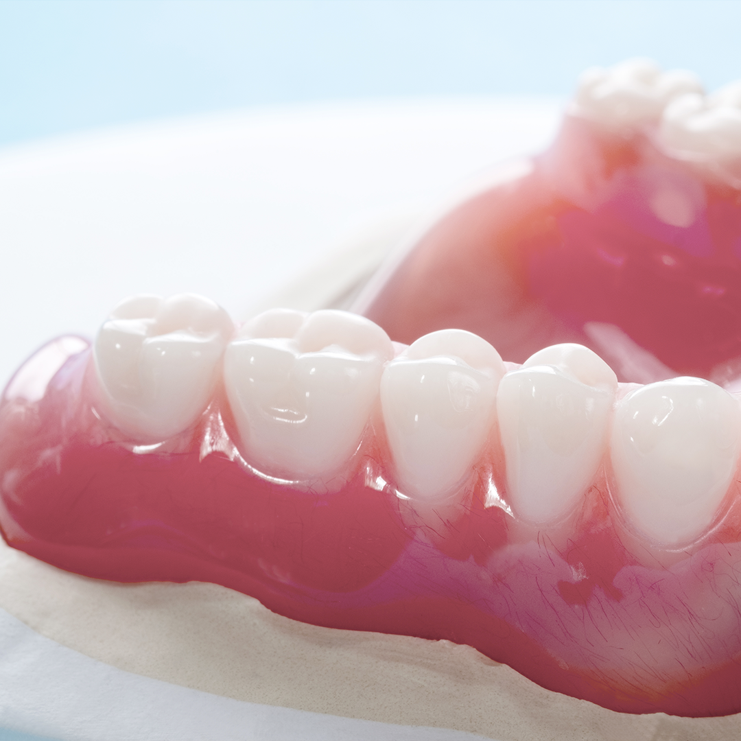 Porcelain Crowns • The Tooth Place